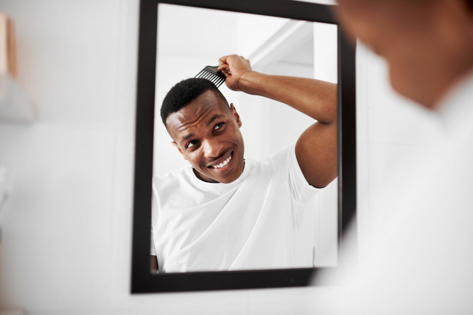 Follicular Unit Extraction in Toronto - Hair Restoration