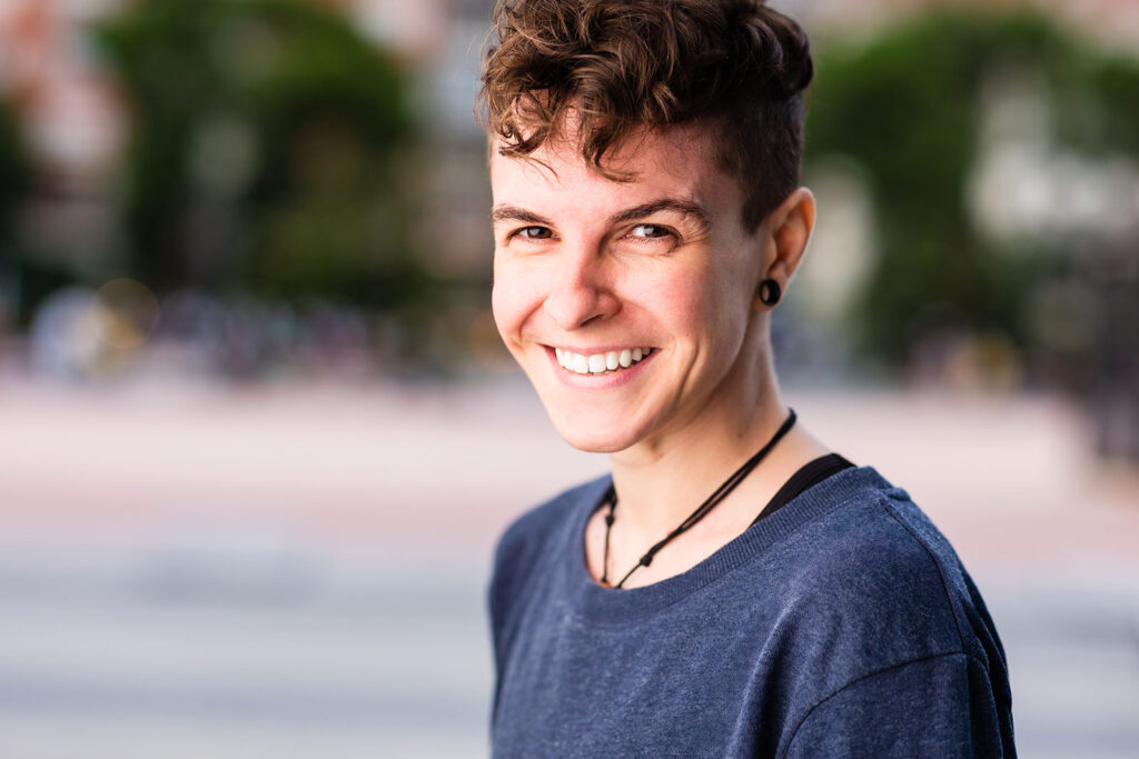 Transgender Masculinization Hair Restoration in Toronto