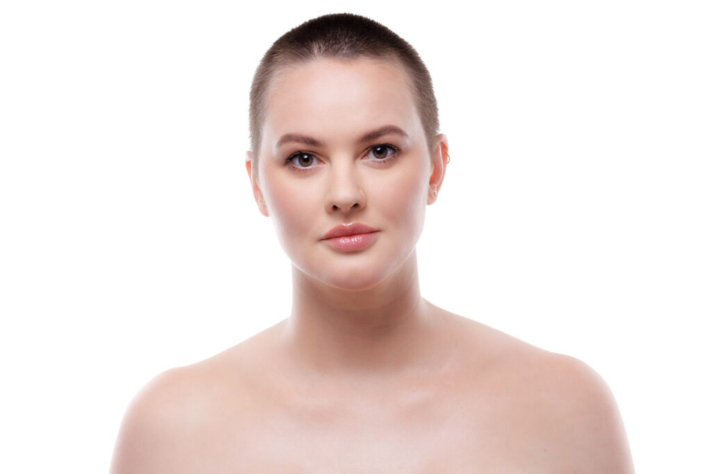 Transgender Feminization Hair Restoration in Toronto – Soft, Natural Look